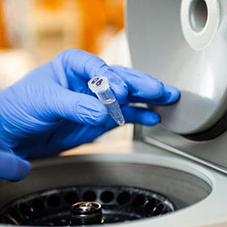 Histopathology Lab in Jaipur: Cancers related Tests | Pathoscope